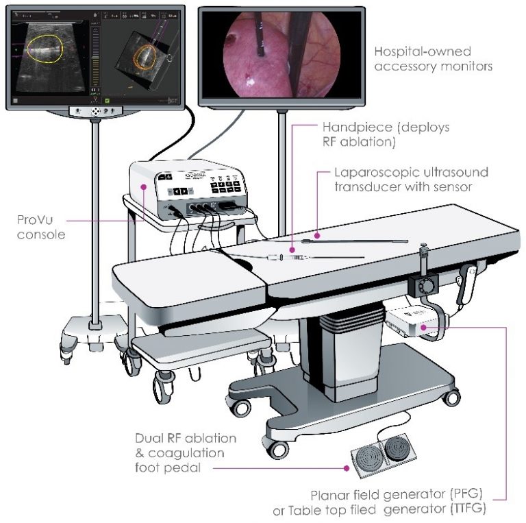 Acessa - John R. Oliver, MD | Gynecologist Wasilla AK